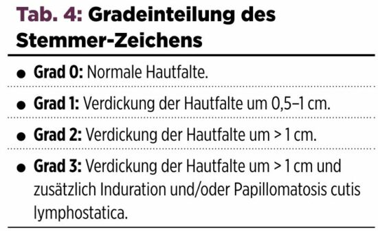 Beinödeme richtig diagnostizieren – Hausärztliche Praxis