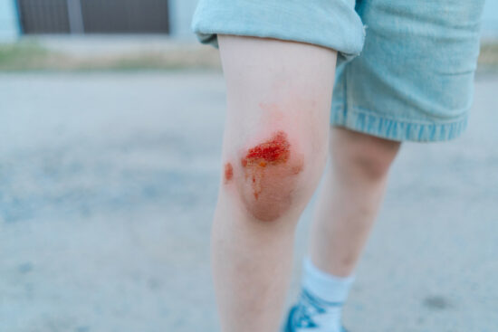 Erstversorgung von Wunden: EBM macht Unterschiede bei Groß und Klein ...